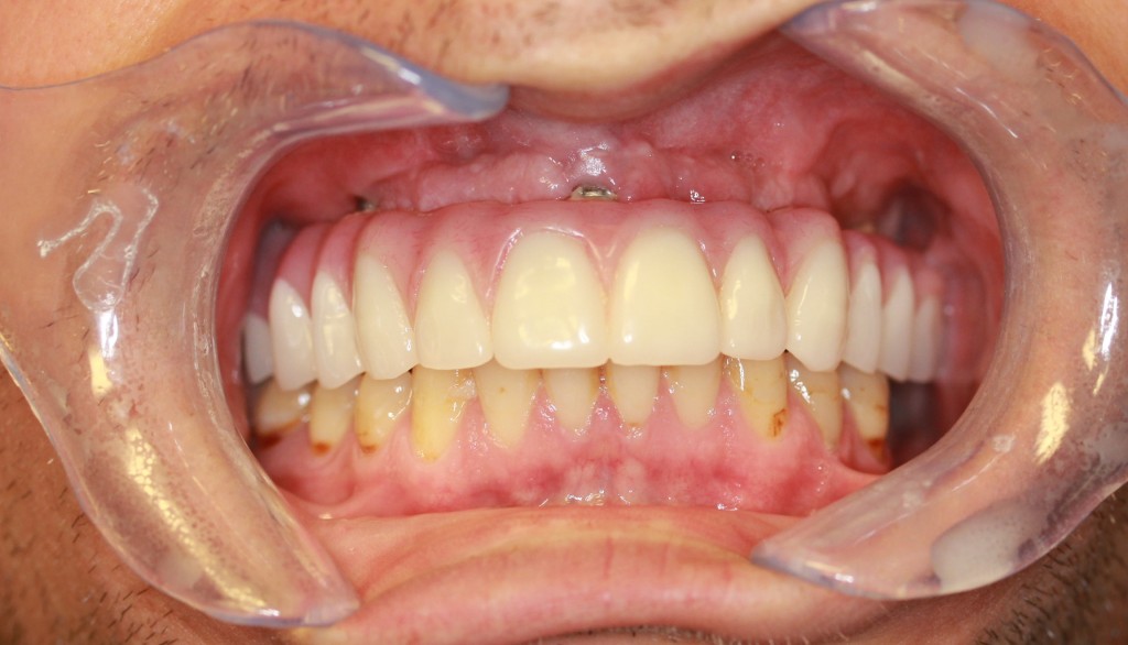 Smile Gallery Killeen Oral & Maxillofacial Surgery | Before & After